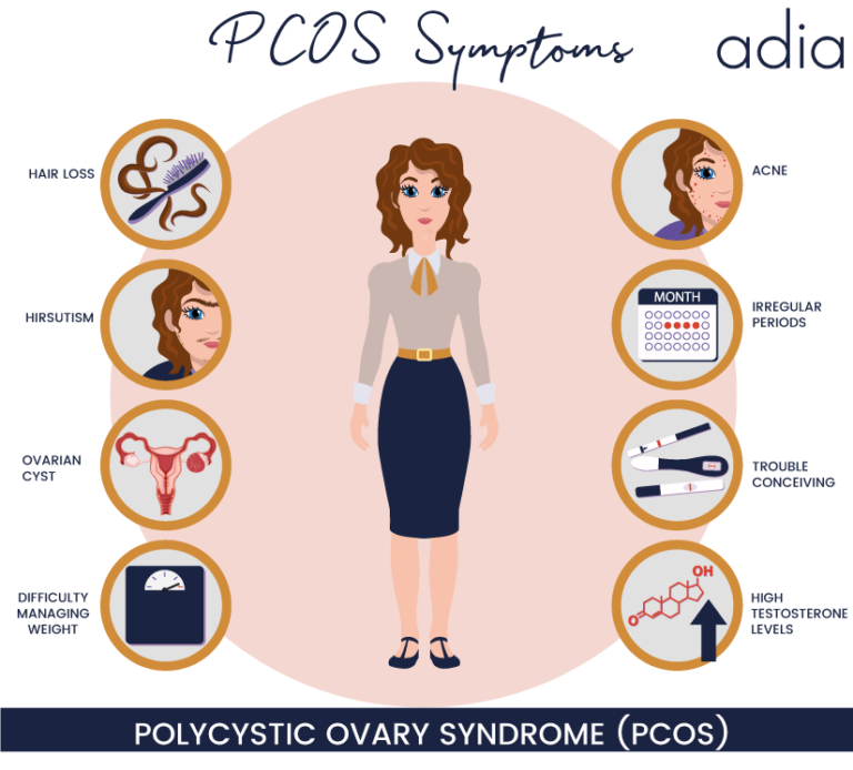 Polycystic Ovary Syndrome (PCOS) - Nutricomplete